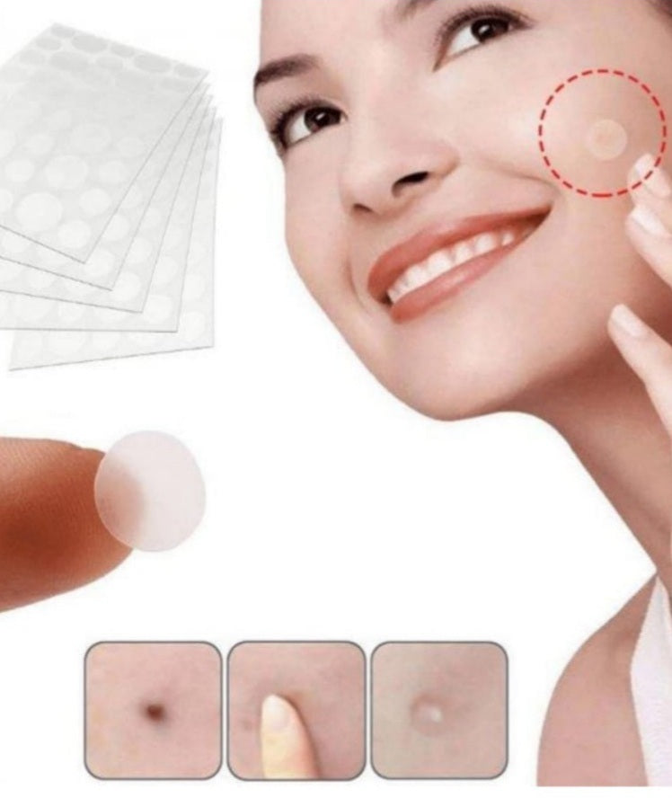 Formu Clear Skin Tag Patches – Elevation